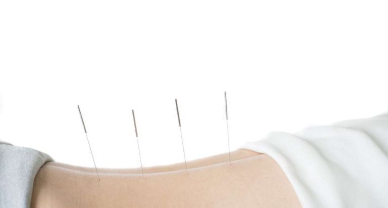 Acupuncture for endometriosis & period pain | The House of Acupuncture
